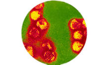 Tekenencefalitis (TBE) | Europees vaccinatie-informatieportaal
